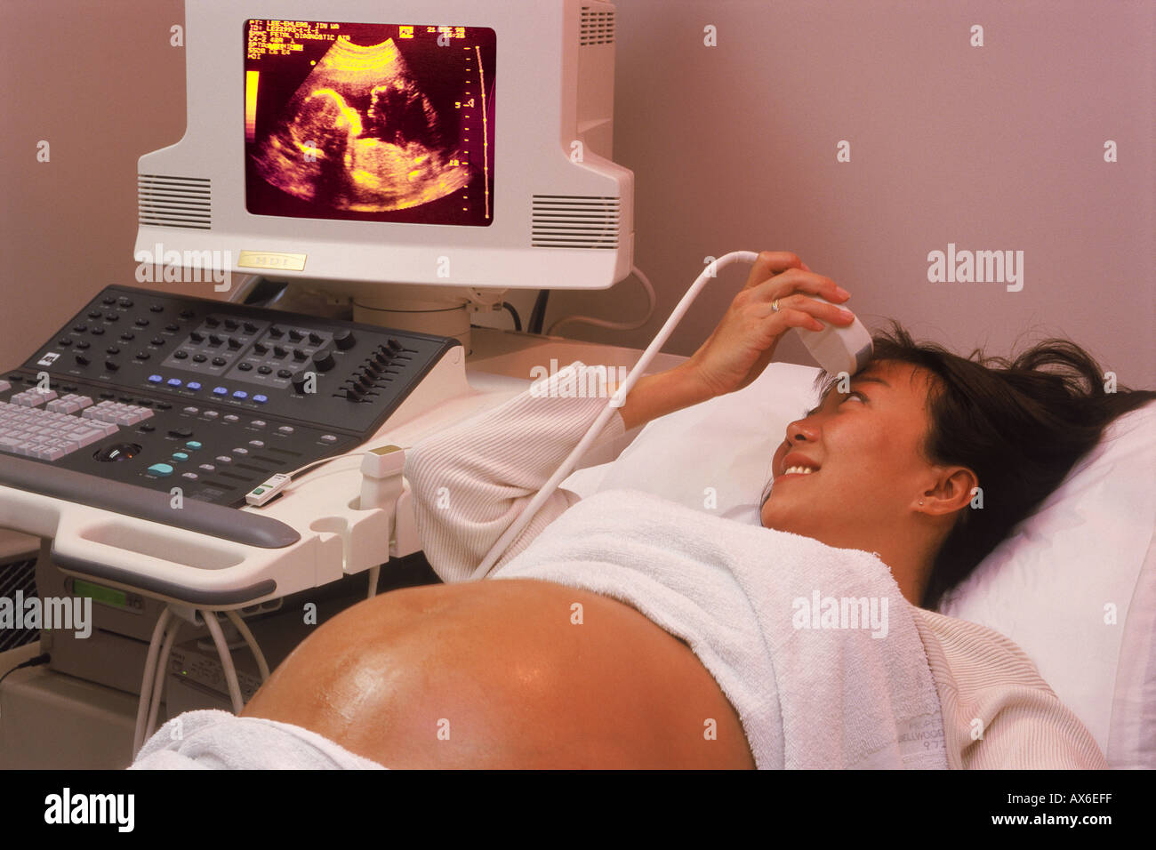 Ultrasound fetus head hi-res stock photography and images - Alamy