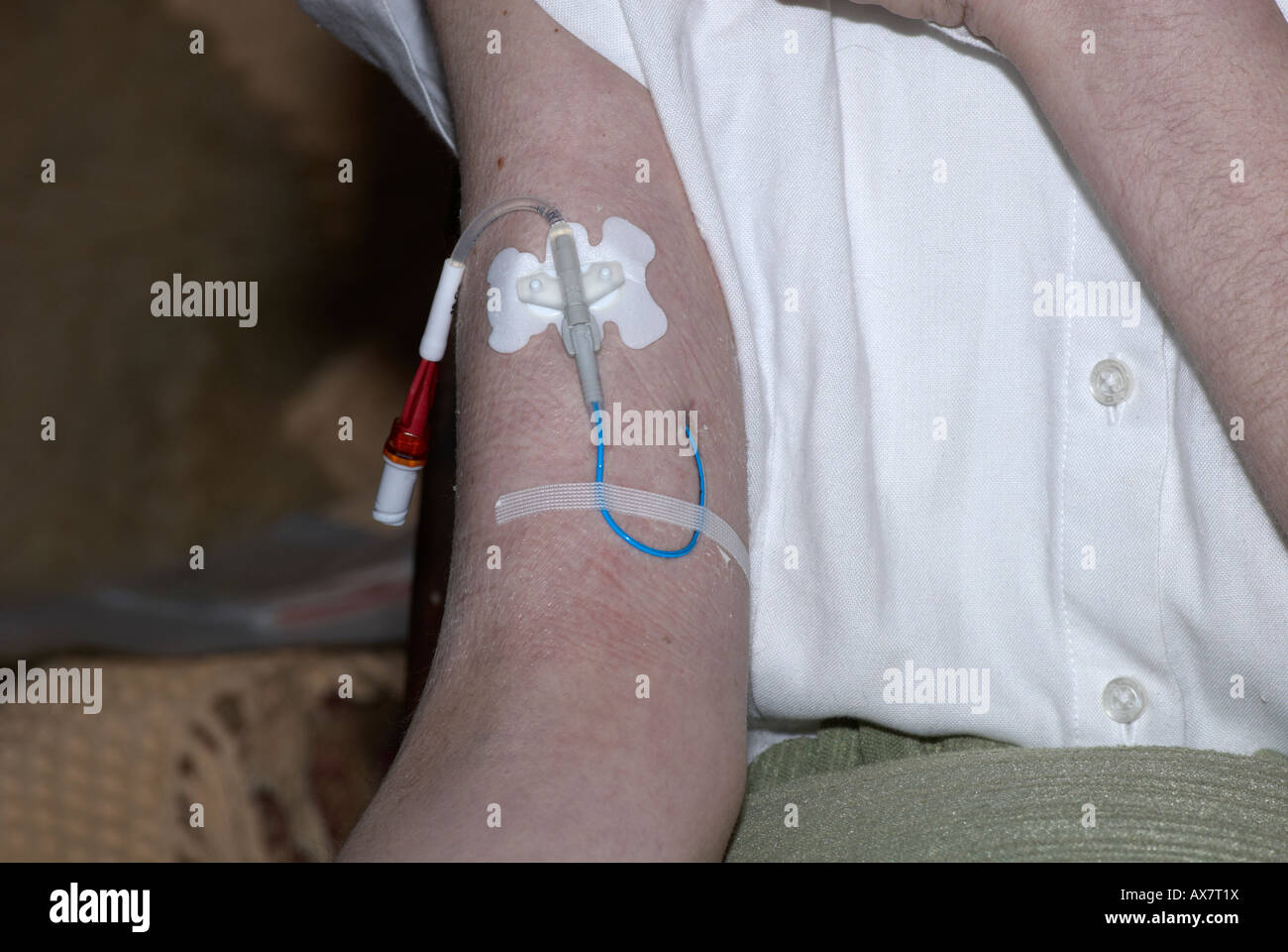 Picc line hi-res stock photography and images - Alamy