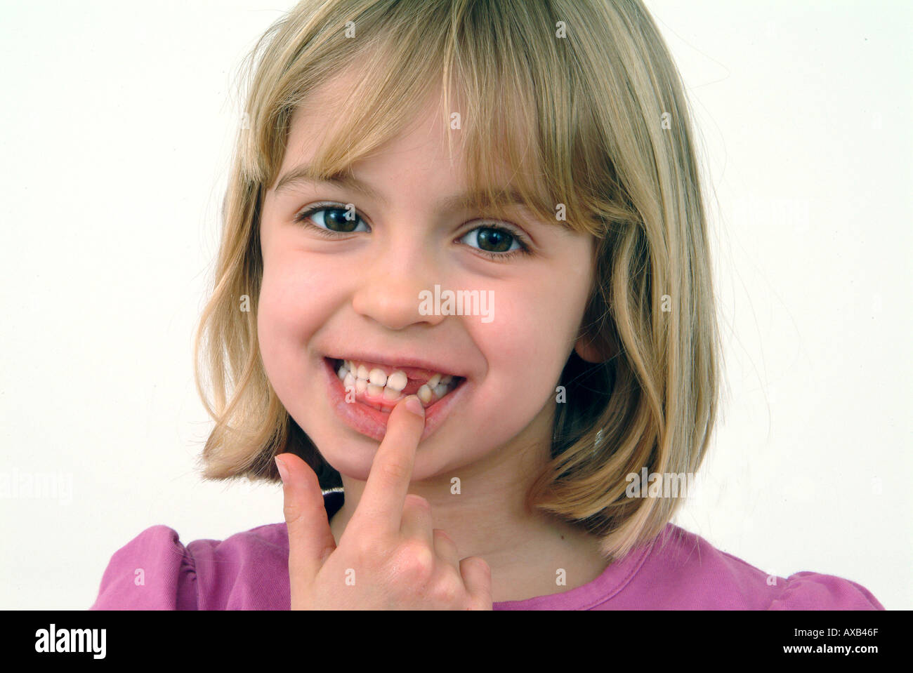 Young Girl With Tooth Missing Wales UK RM1 Stock Photo - Alamy