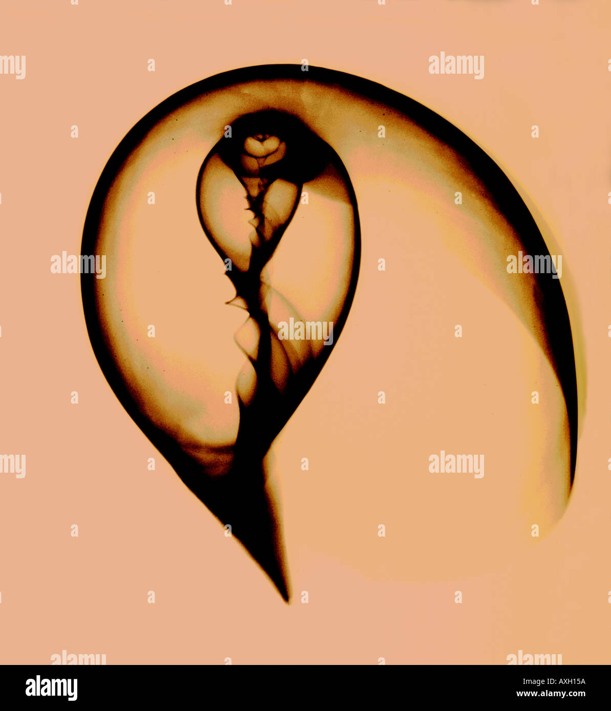 X-ray African Melon Sea Shell (Radiograph Stock Photo - Alamy