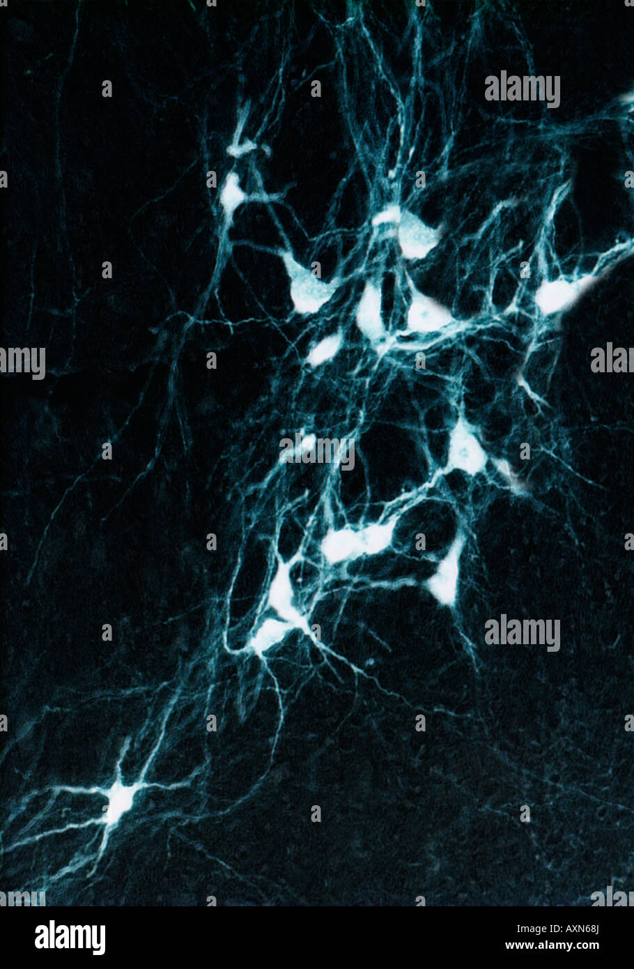 Human Brain Cells Under A Microscope