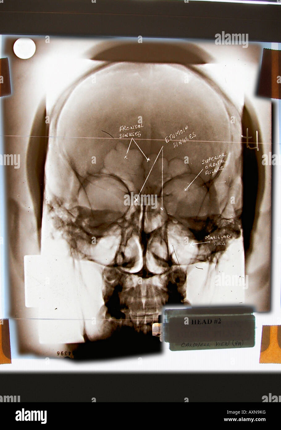 x ray of scull Stock Photo - Alamy