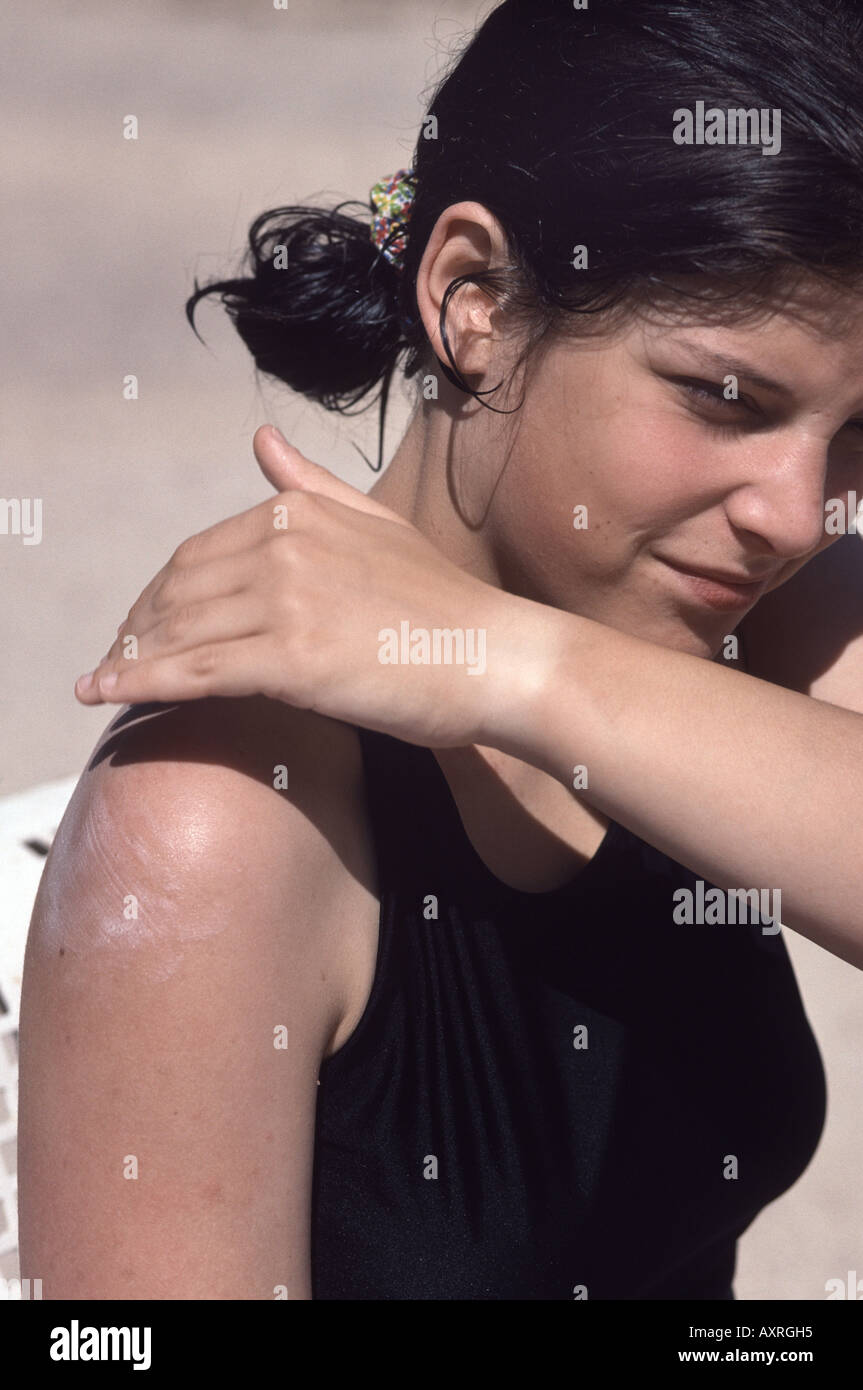teenage girl applying sunscreen to shoulders Stock Photo - Alamy