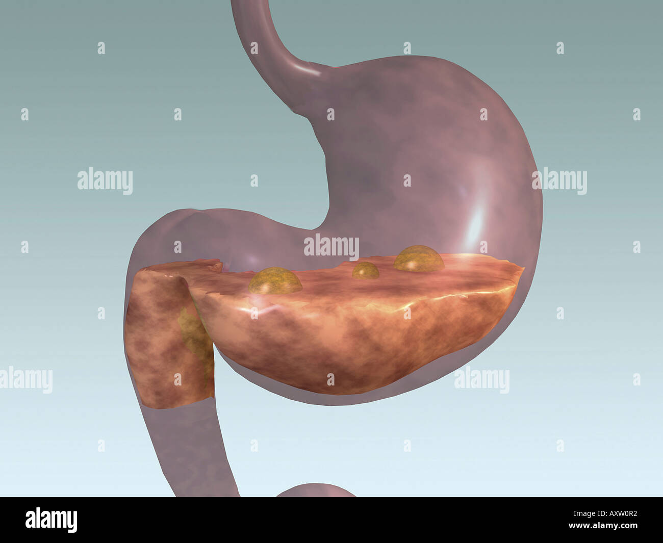 Human esophagus and stomach hi-res stock photography and images - Alamy
