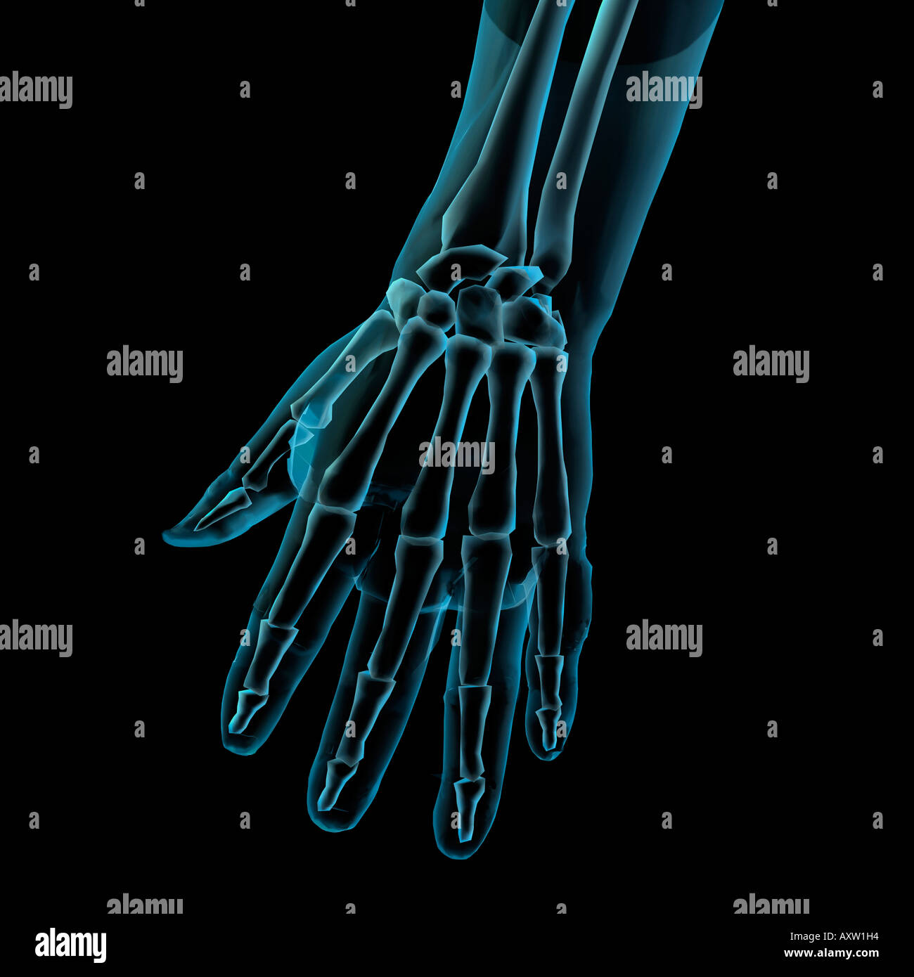 X-ray of a hand Stock Photo - Alamy