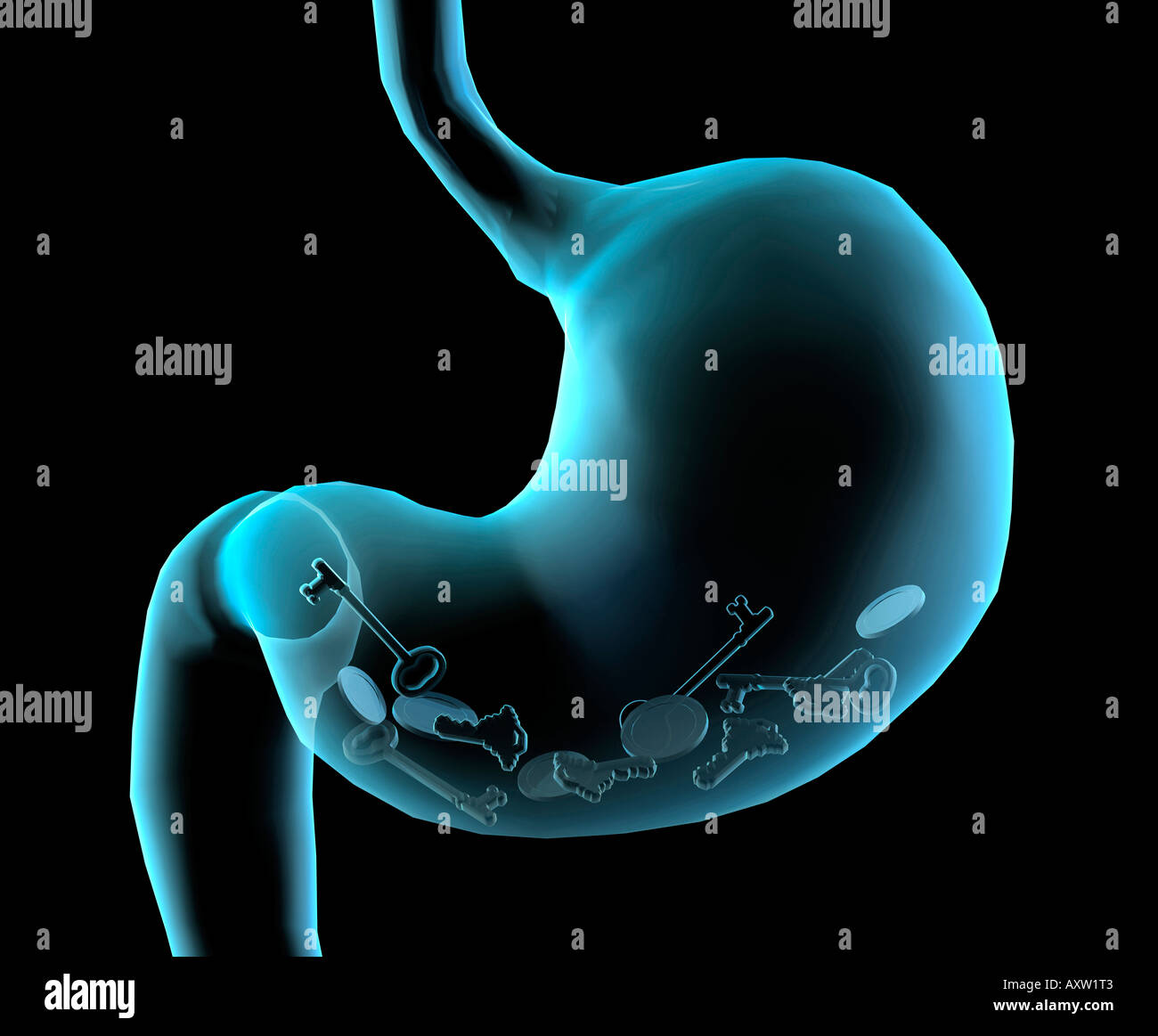 X-ray of a stomach Stock Photo - Alamy