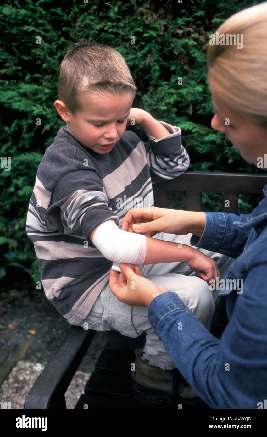 Boy with an injured arm Stock Photo - Alamy