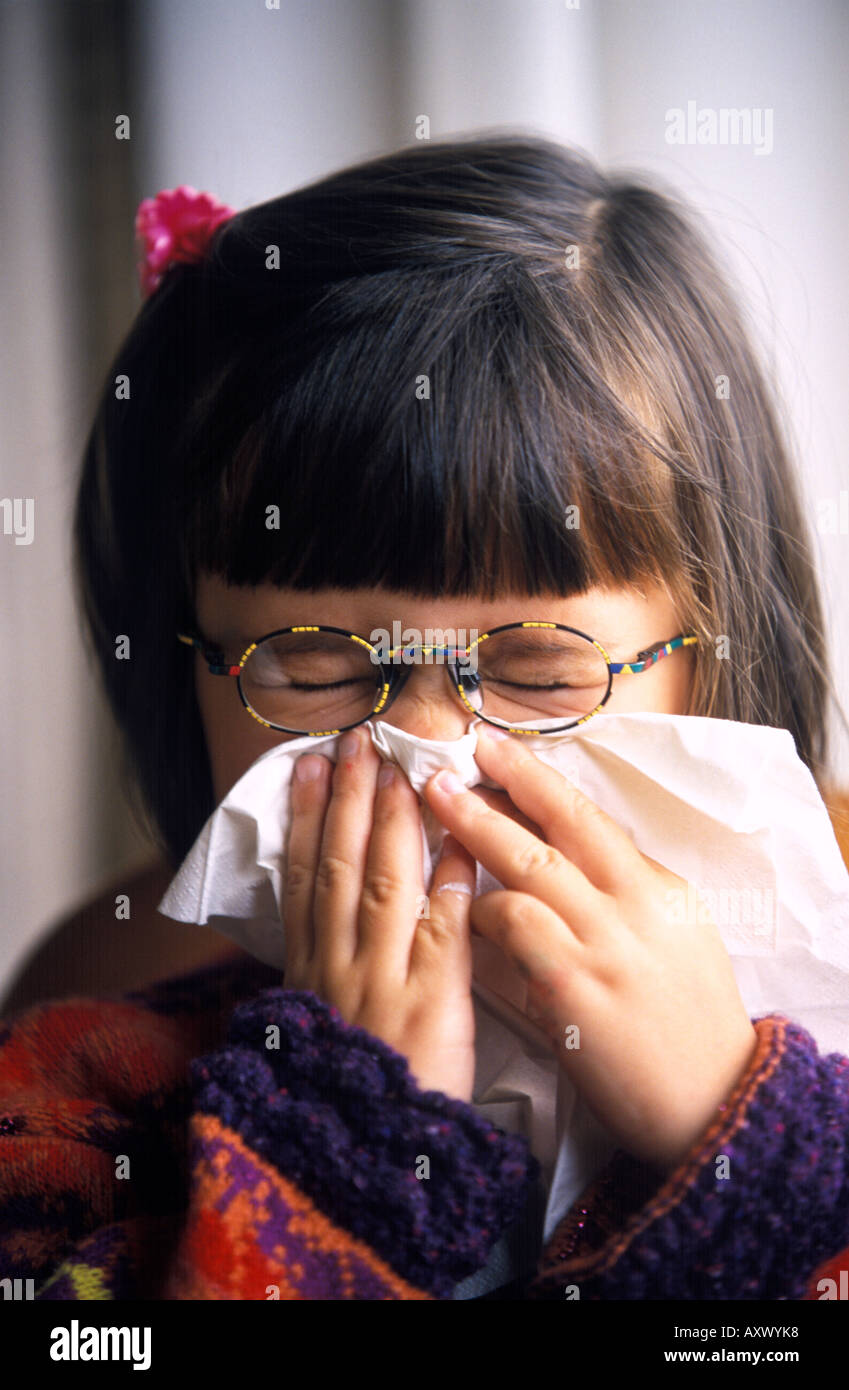 Girl with allergy Stock Photo - Alamy