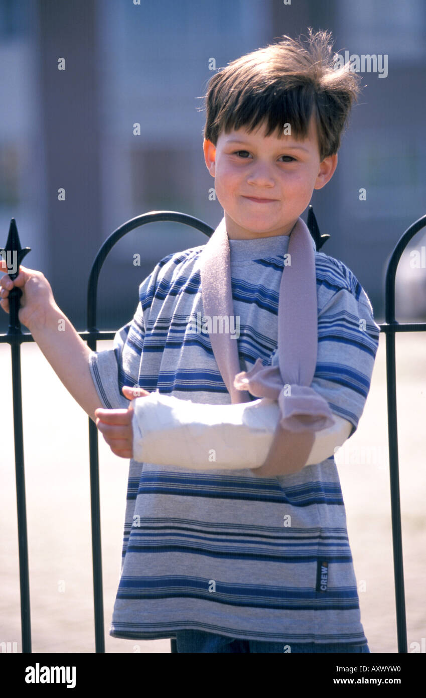 Boy with a broken arm Stock Photo - Alamy