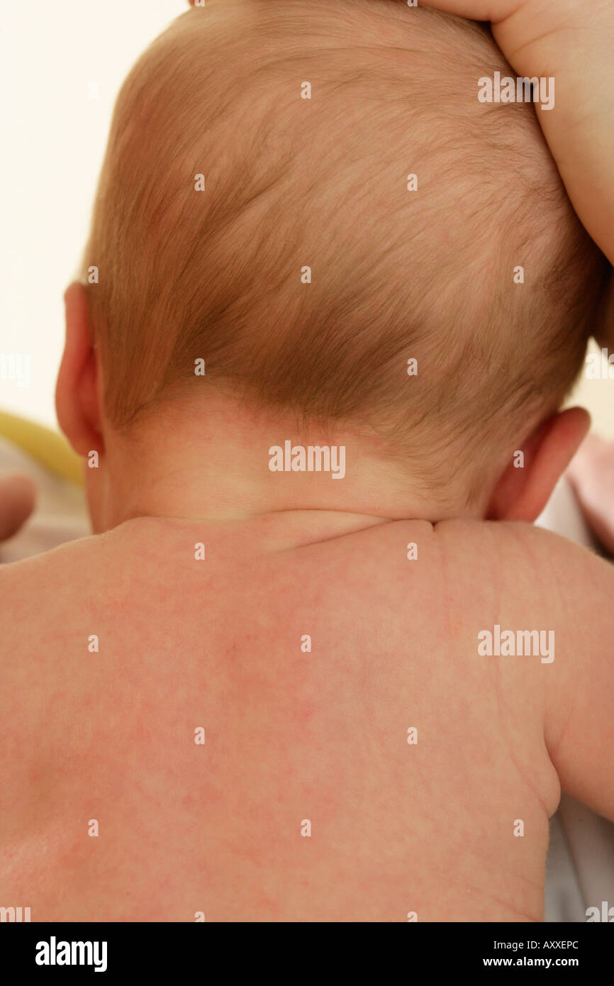 Healthy spine hi-res stock photography and images - Alamy