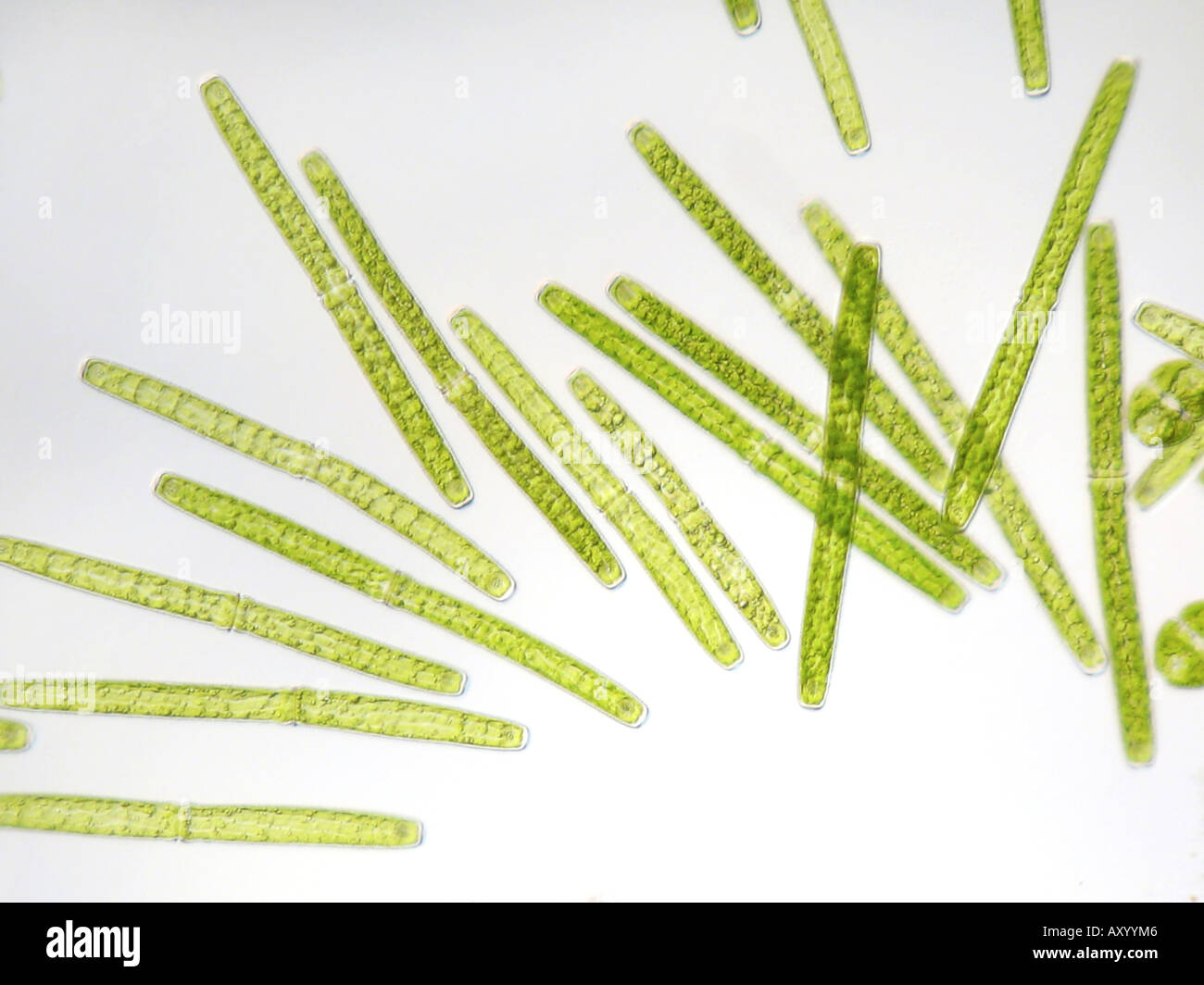 Pleurotaenium trabecula (Pleurotaenium trabecula), in shining-through ...