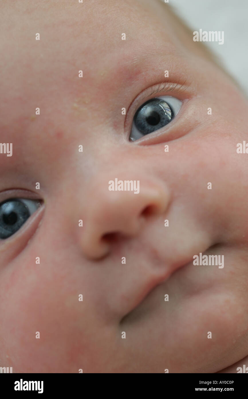 Mottled skin child hi-res stock photography and images - Alamy