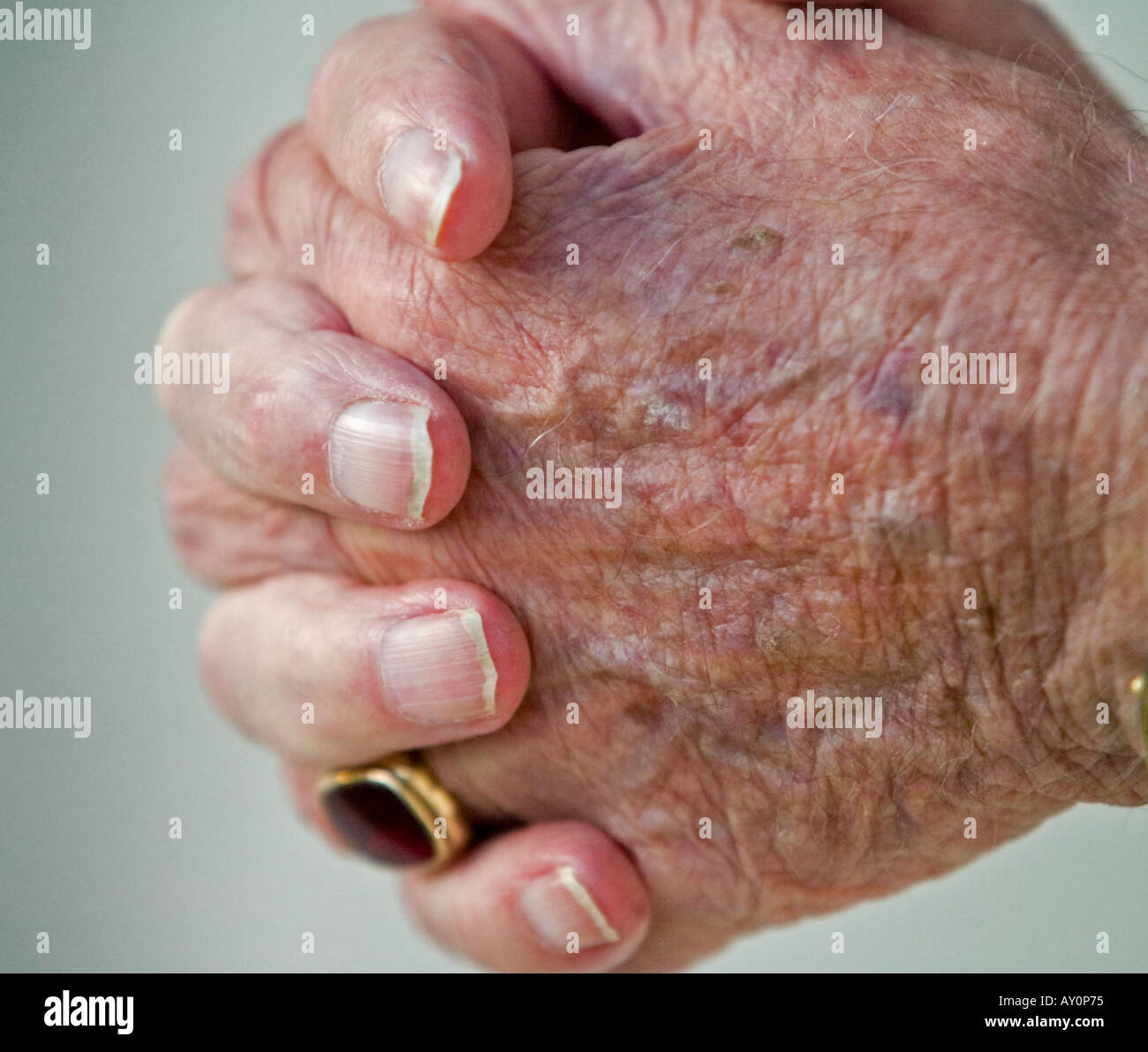 Hands of a senior citizen Stock Photo - Alamy