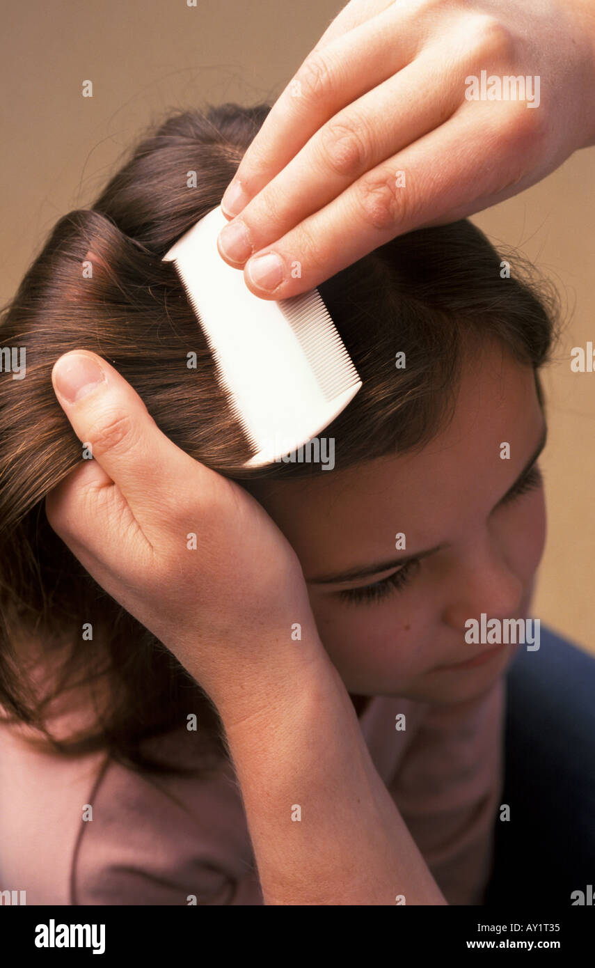 Eight year old girl is checked for lice in her hair Stock Photo - Alamy