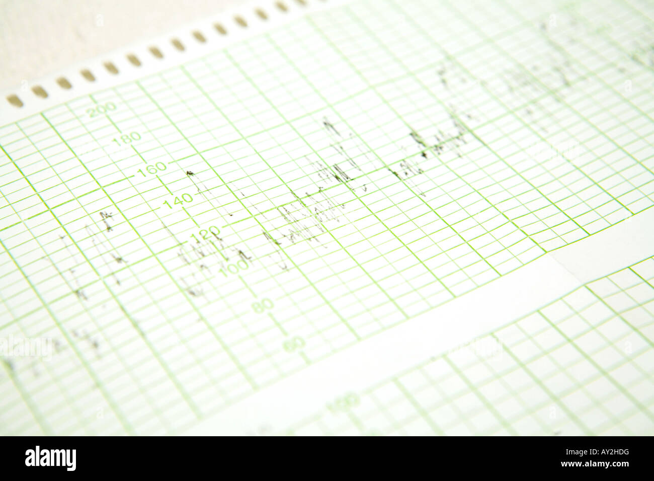 Graph of fetus heart beat Stock Photo - Alamy