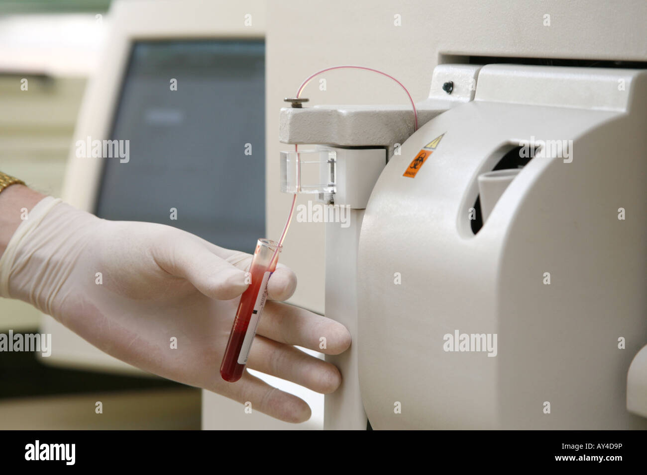 Laboratory testing blood Stock Photo - Alamy
