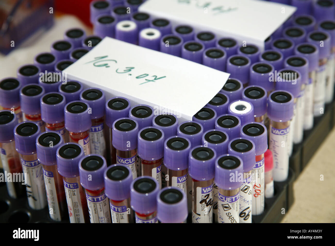 Glass tubes with blood Stock Photo - Alamy