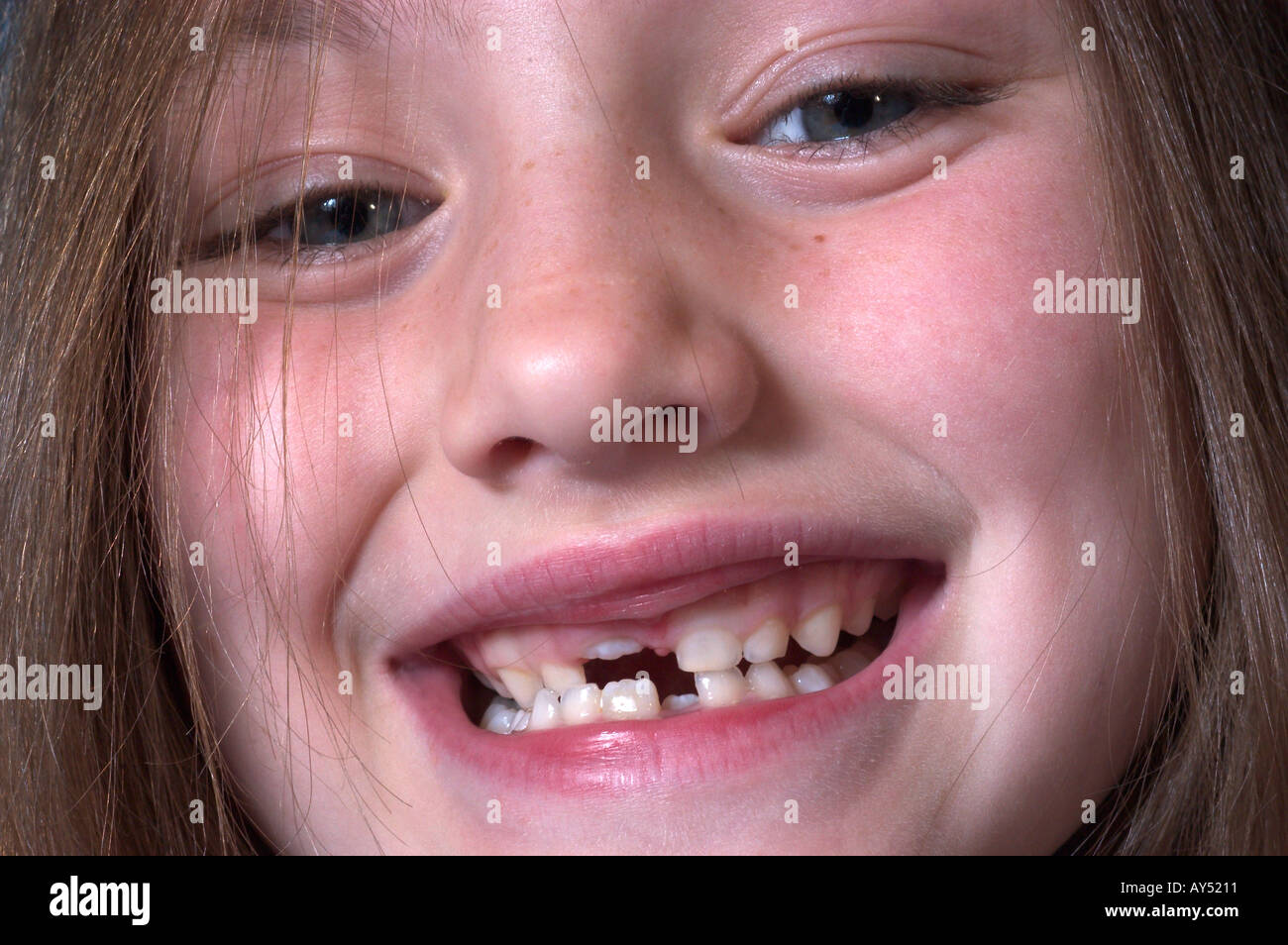 Young 7 year old girl with new teeth coming in Stock Photo - Alamy