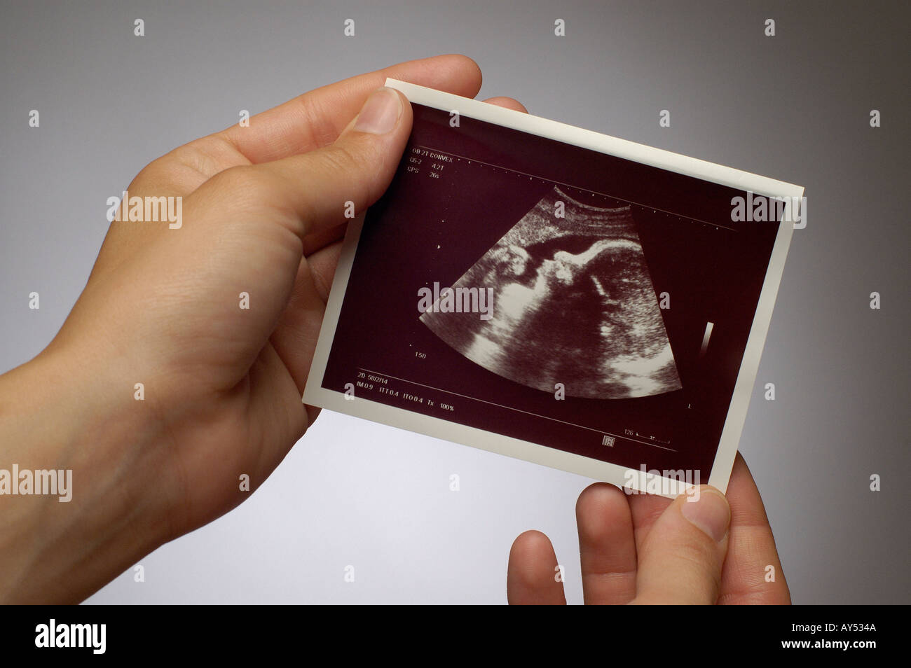 ULTRASOUND IMAGE SCAN Stock Photo - Alamy