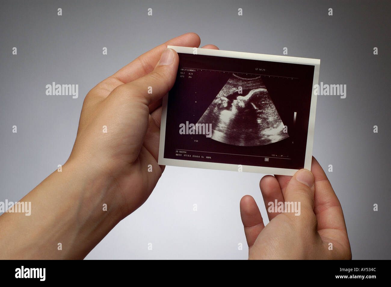 Ultrascan health pregnancy examination hi-res stock photography and ...