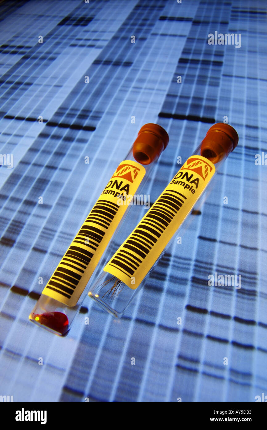 Two vials one containing a blood sample and one a hair for DNA research ...