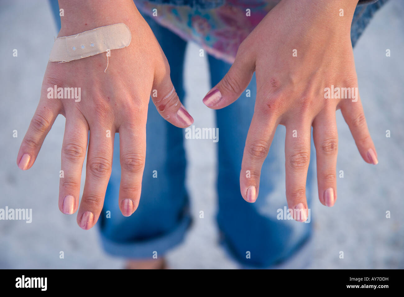 Injured female sculptor hands after hard work Istanbul Turkey Stock ...