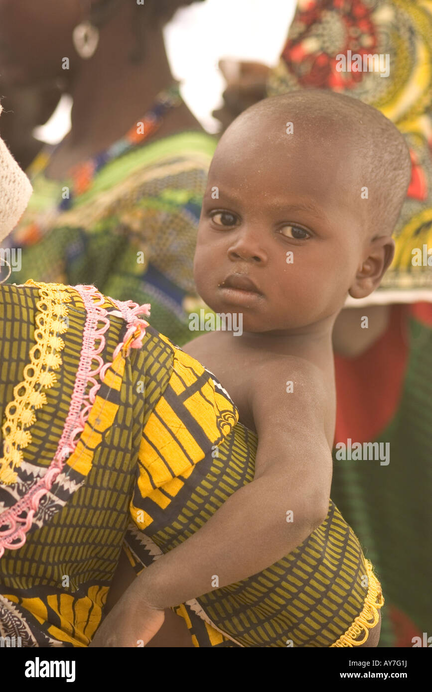 Malnourished child hi-res stock photography and images - Alamy