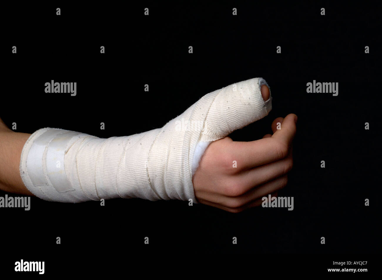 Hand in plaster bandage Stock Photo - Alamy