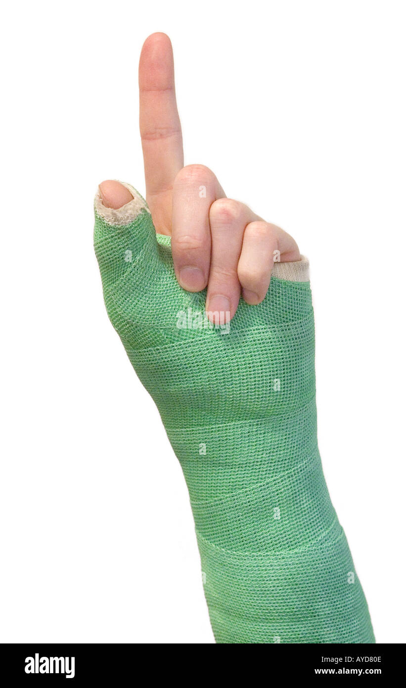 Cast broken hand thumb Cut Out Stock Images & Pictures - Alamy