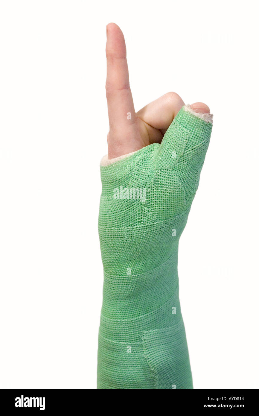 Medical cast texture hi-res stock photography and images - Alamy