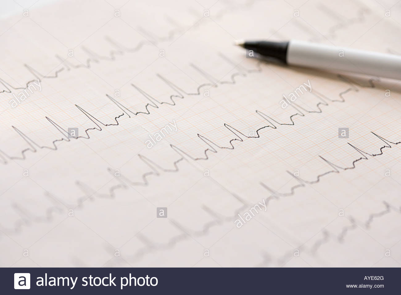 Ecg Test Stock Photos & Ecg Test Stock Images - Alamy