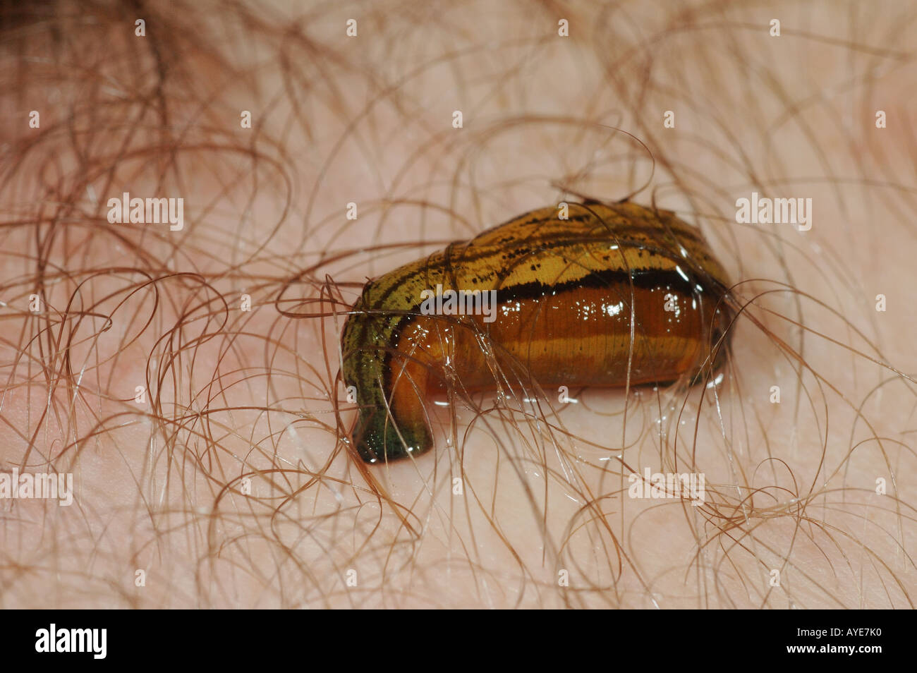 Leech bite hi-res stock photography and images - Alamy