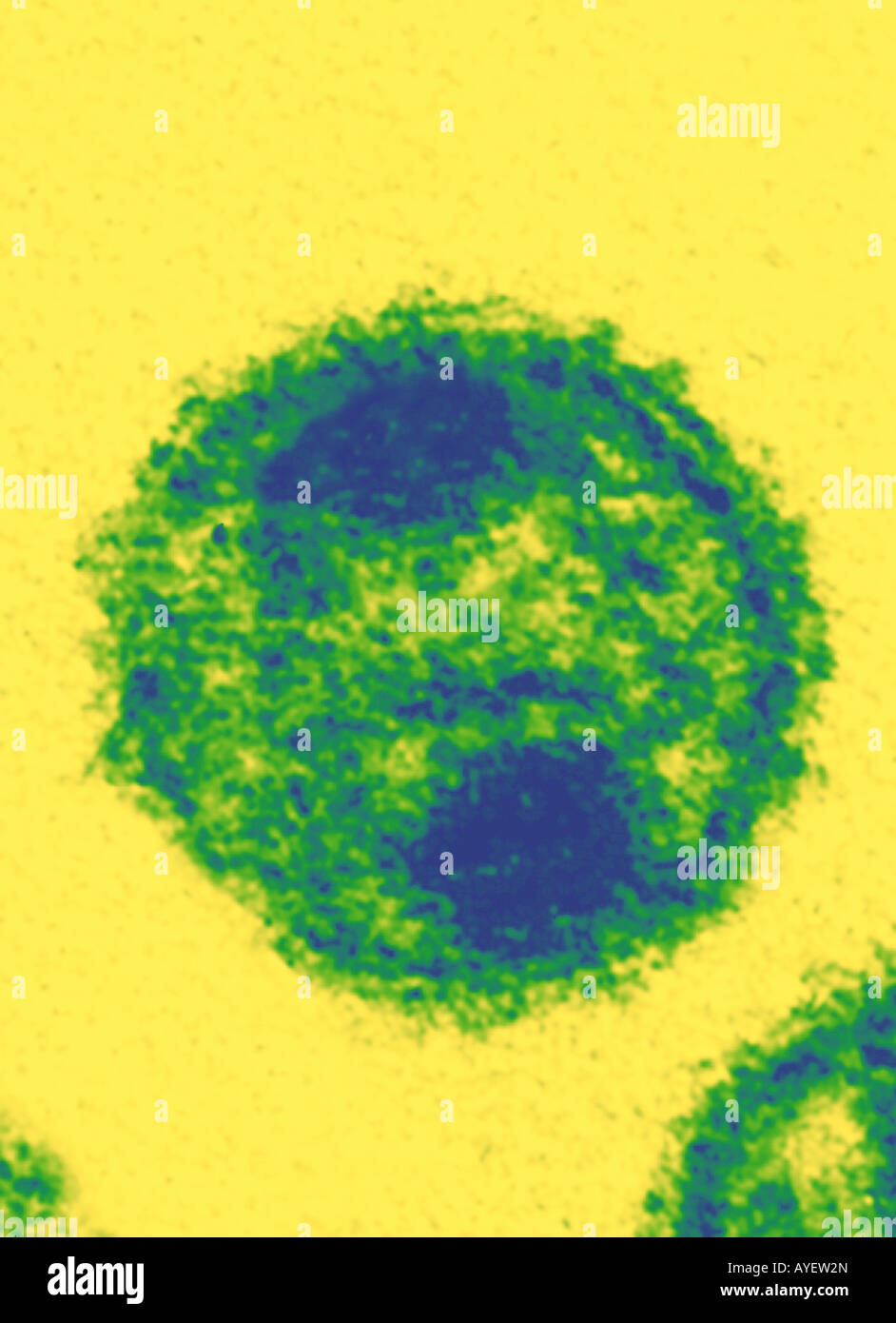 HIV virus AIDS virus as seen through EM microscope Stock Photo - Alamy
