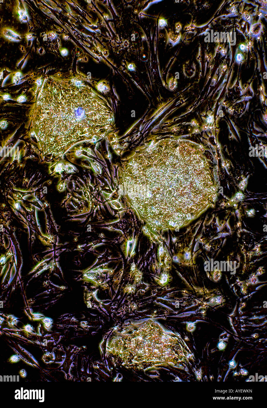 human embryonal stem cell as seen through light microscope Stock Photo ...