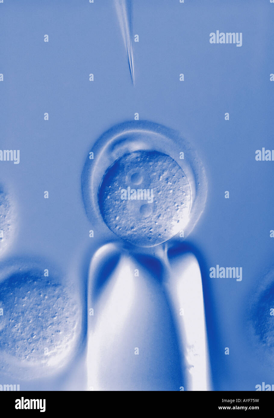 Cloning microinjection of human embryonal stem cells ES cells into egg ...