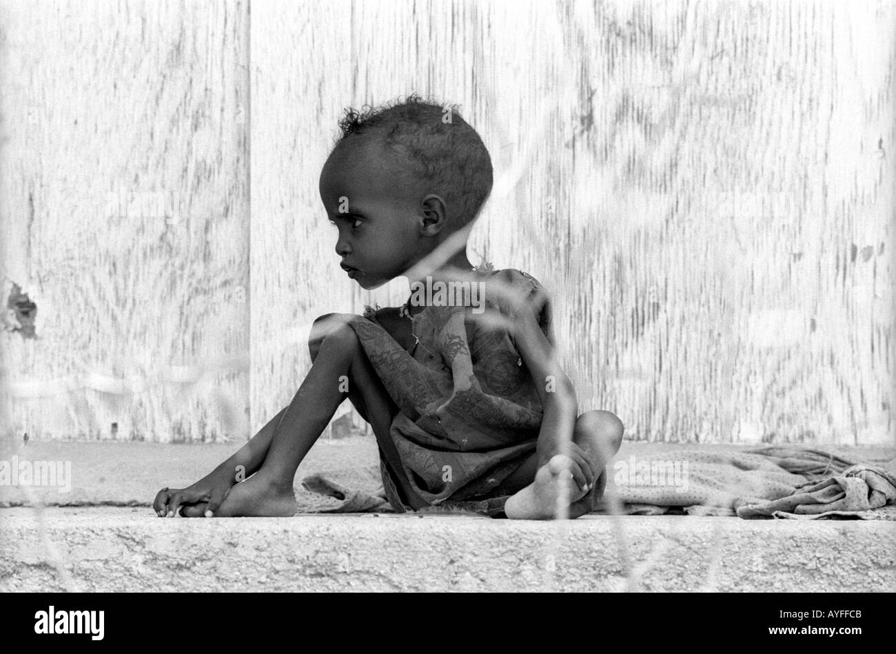 Ethiopia famine hi-res stock photography and images - Alamy