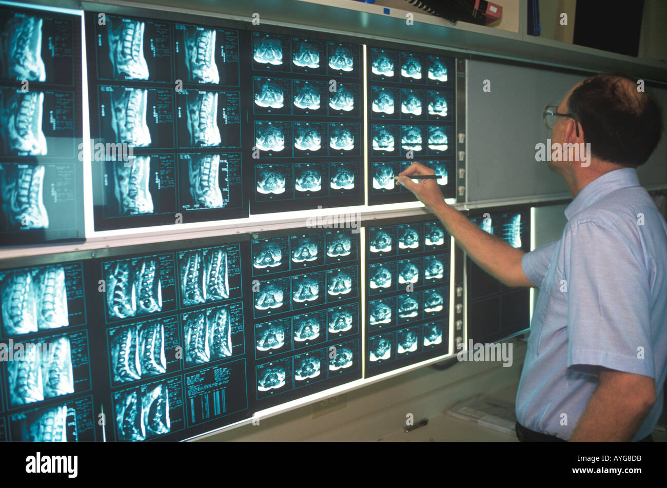 Radiologist reads magnetic resonance images Stock Photo - Alamy