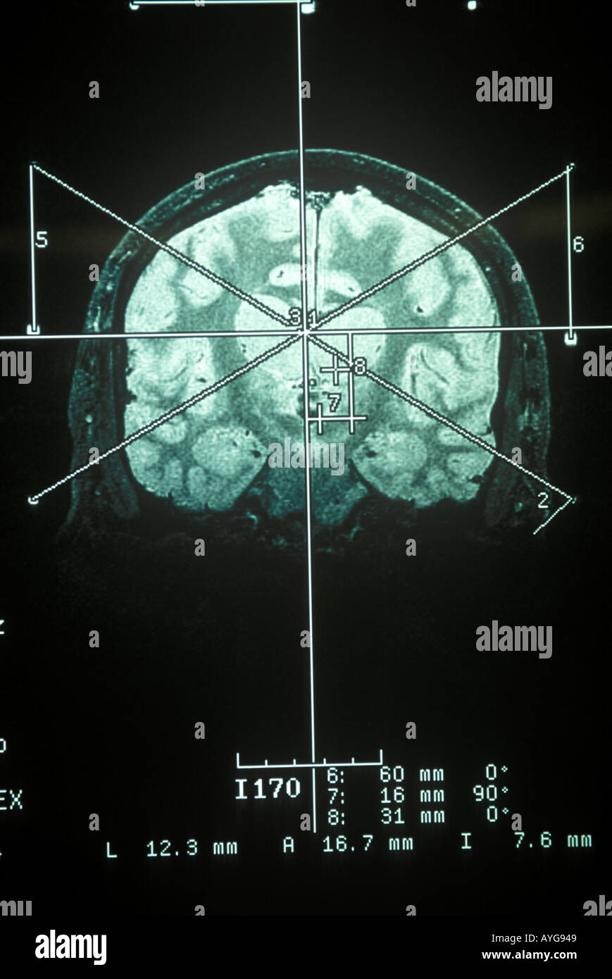 Human brain mri Stock Photo - Alamy