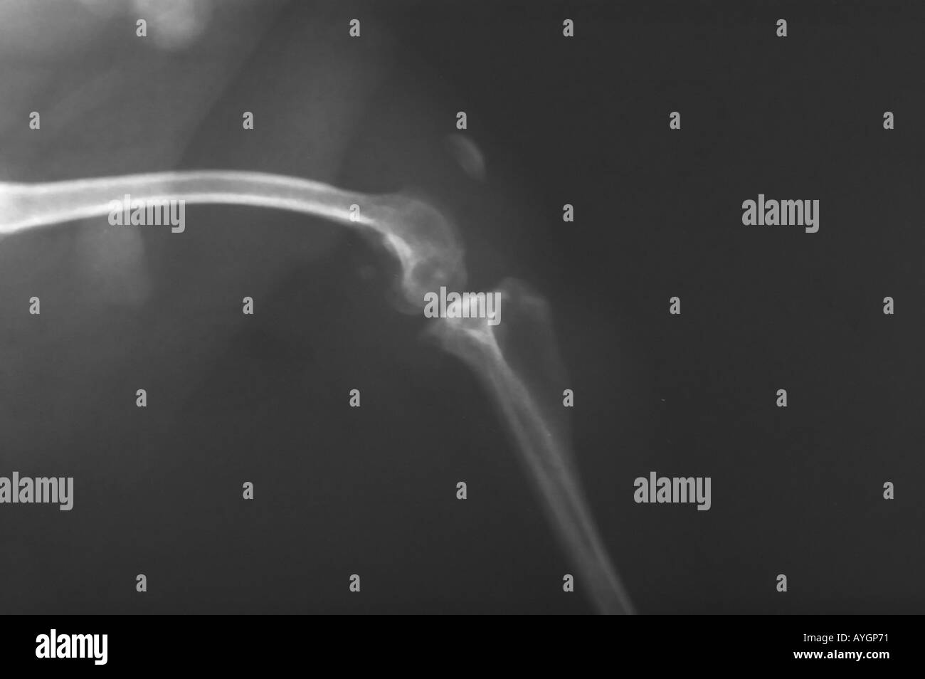 Synovial joint Black and White Stock Photos & Images - Alamy