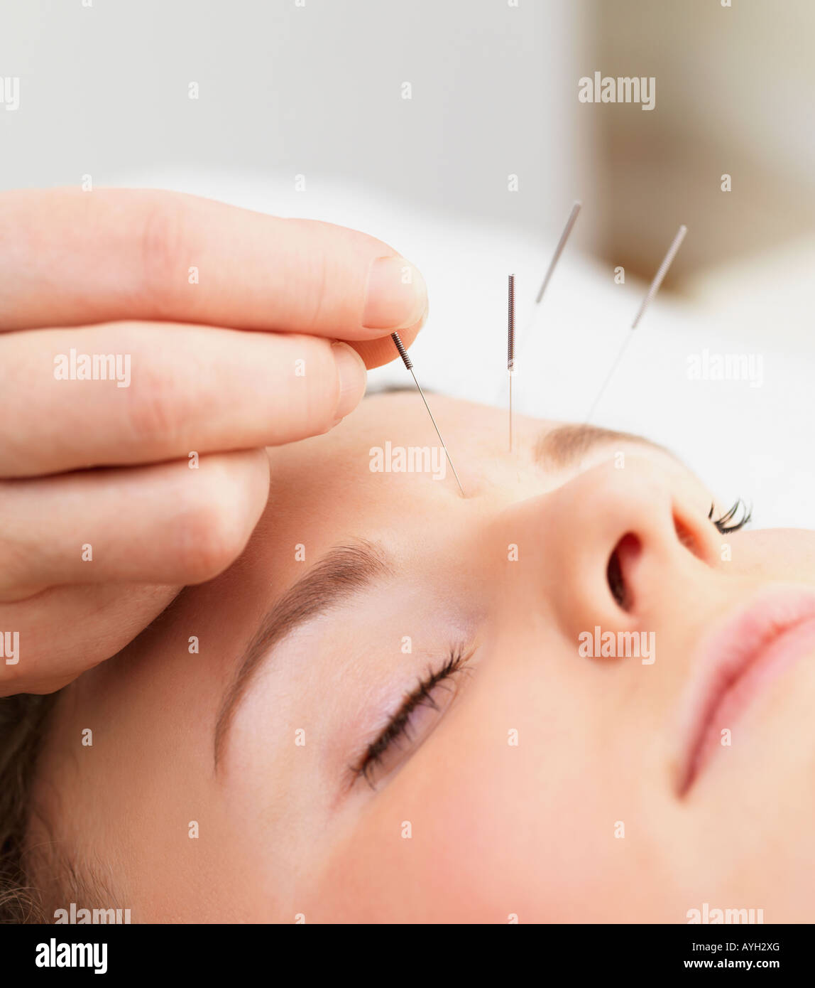 Woman acupuncture face hi-res stock photography and images - Alamy