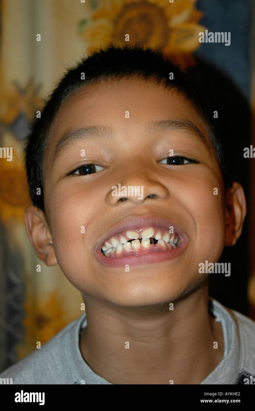 boy child tooth health dentist dental Stock Photo - Alamy