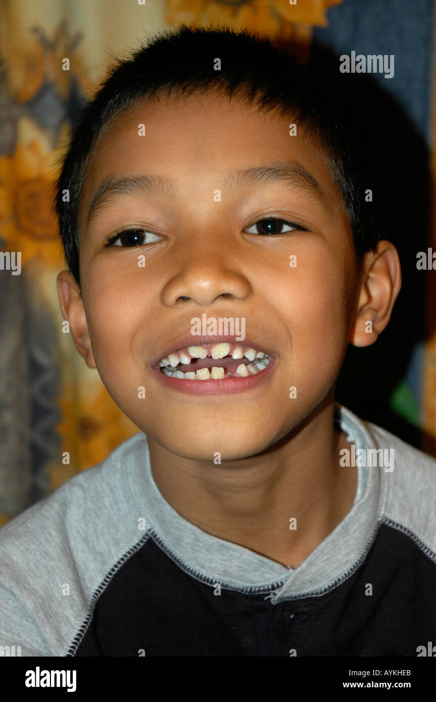 boy child tooth health dentist dental Stock Photo - Alamy