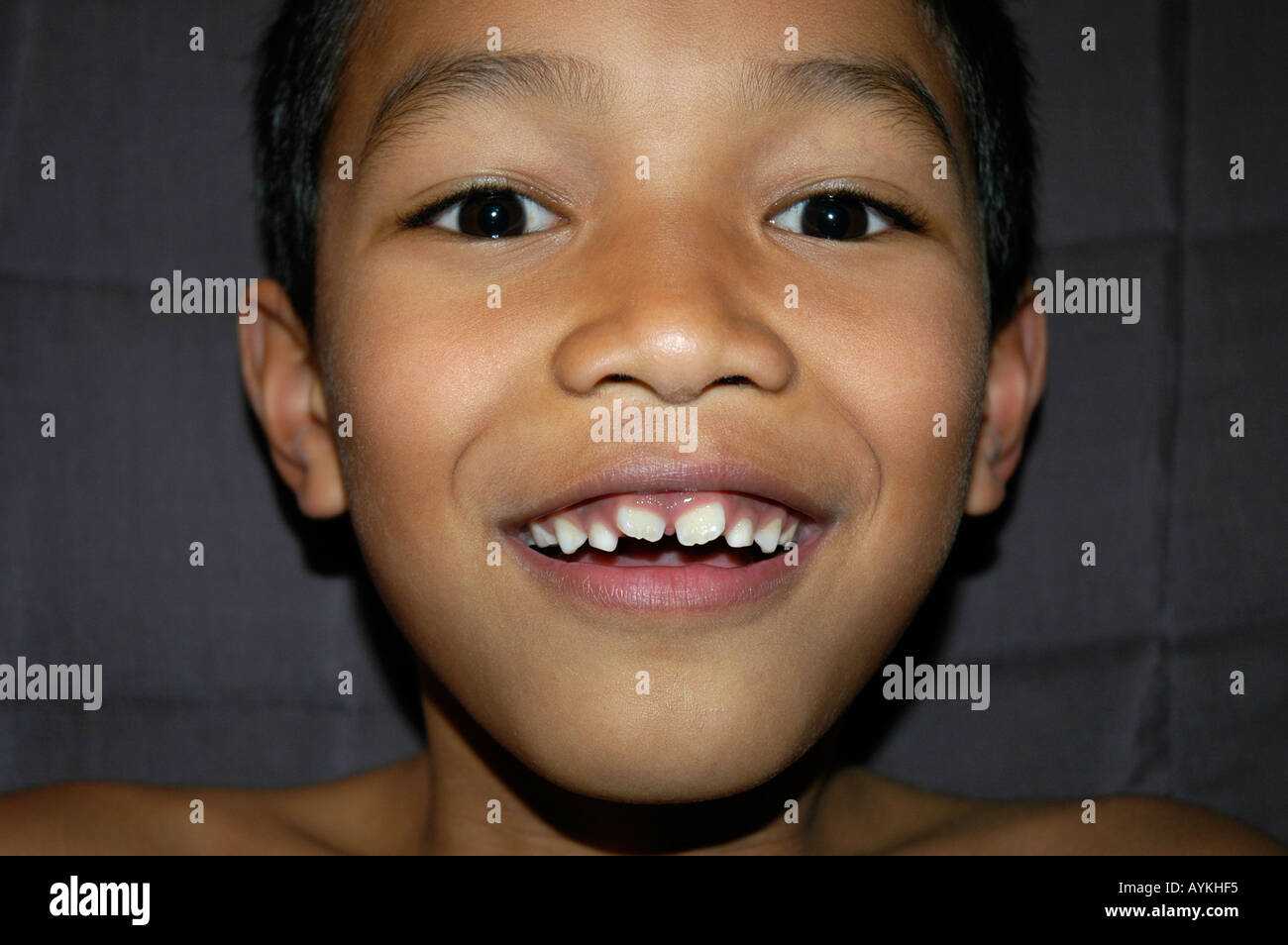 boy child tooth health dentist dental Stock Photo - Alamy