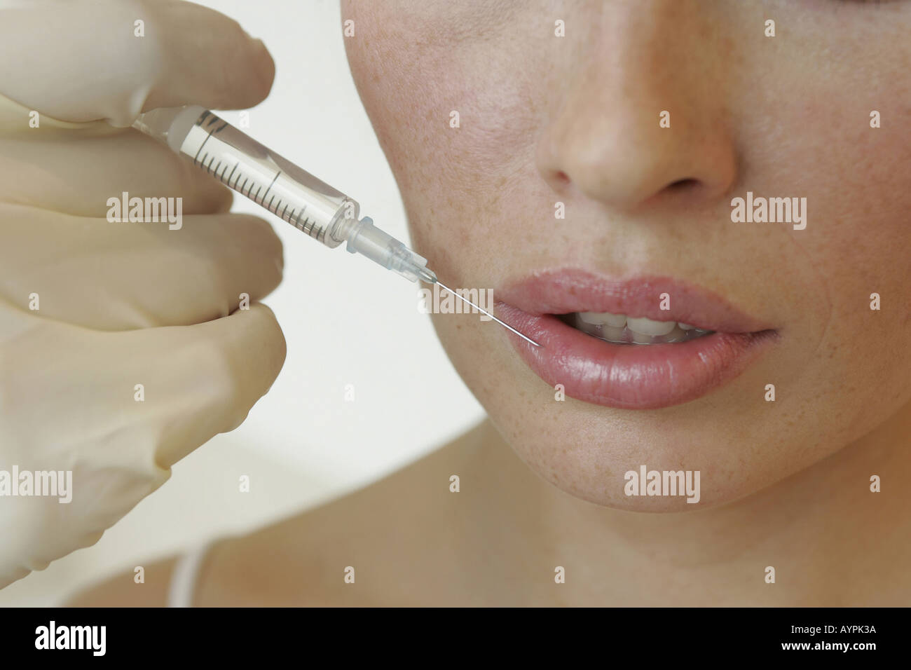 Close up of a woman getting a collagen injection in her lip Stock Photo ...