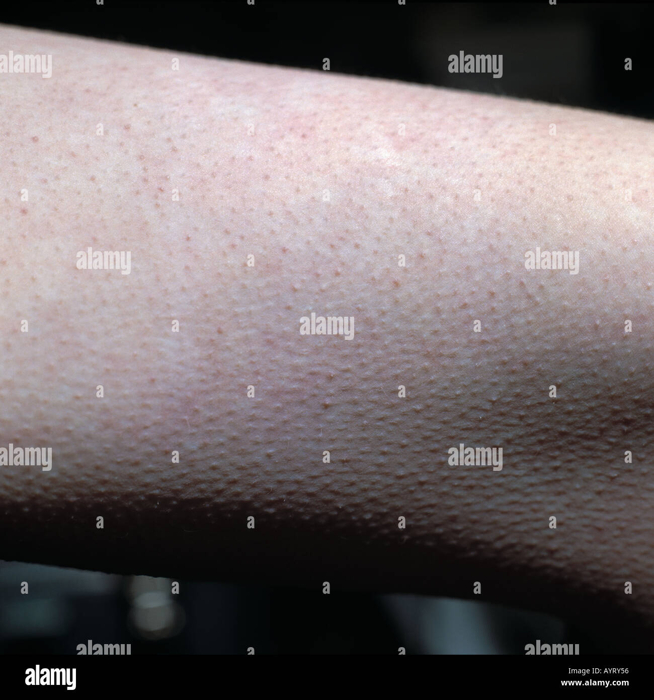 Goose bumps hi-res stock photography and images - Alamy