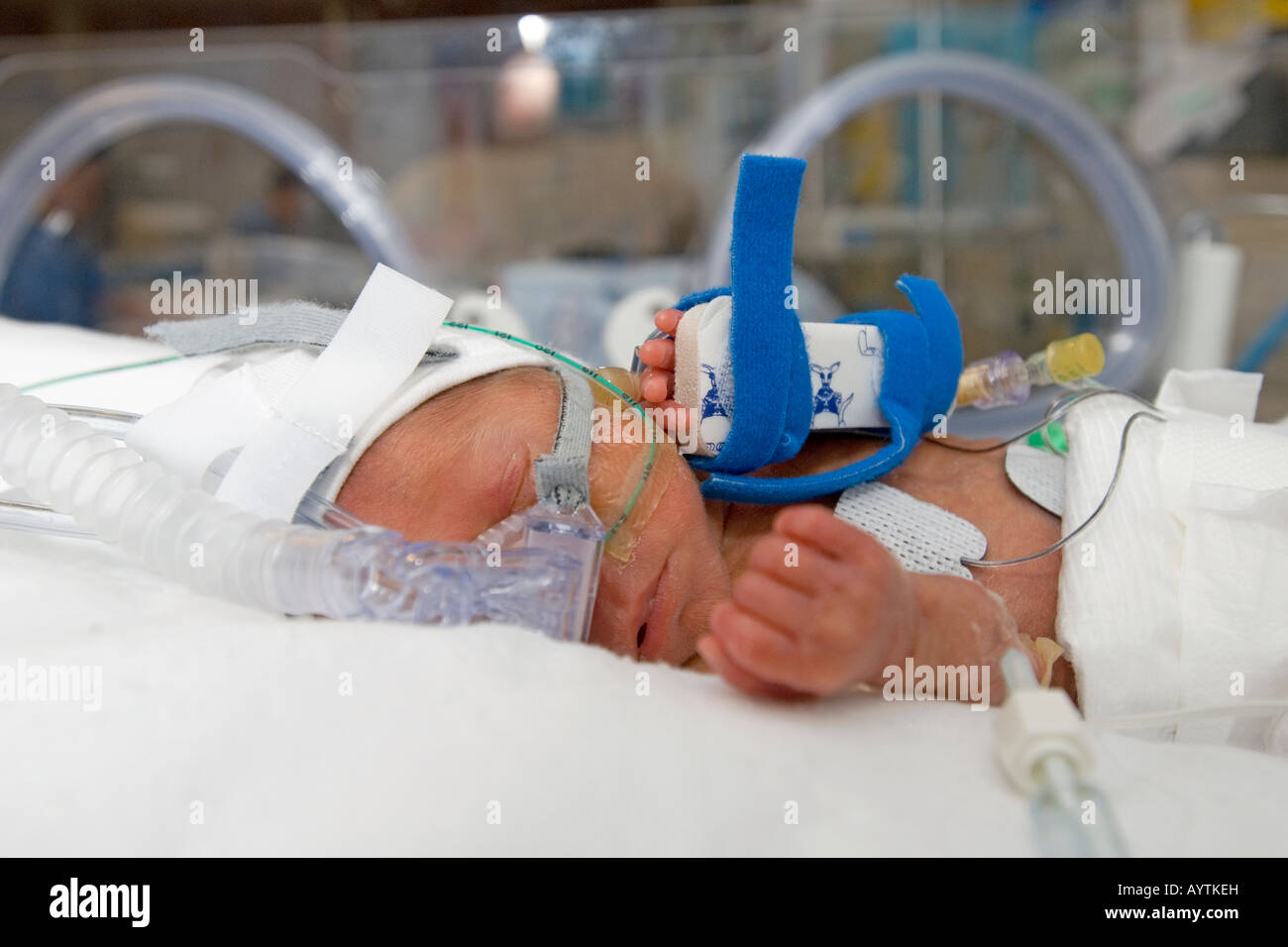 Premature baby incubator hi-res stock photography and images - Alamy