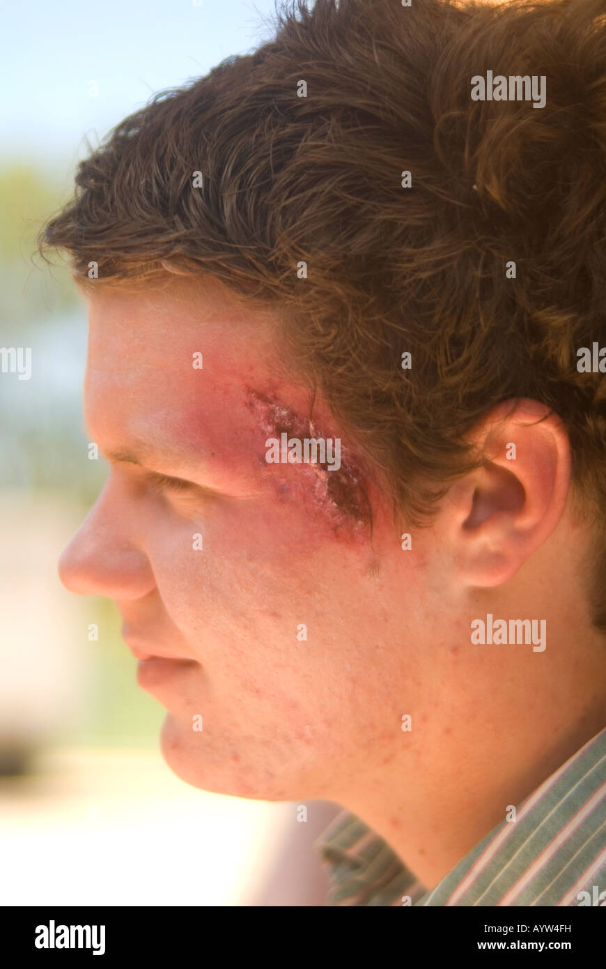 Fake accident hi-res stock photography and images - Alamy