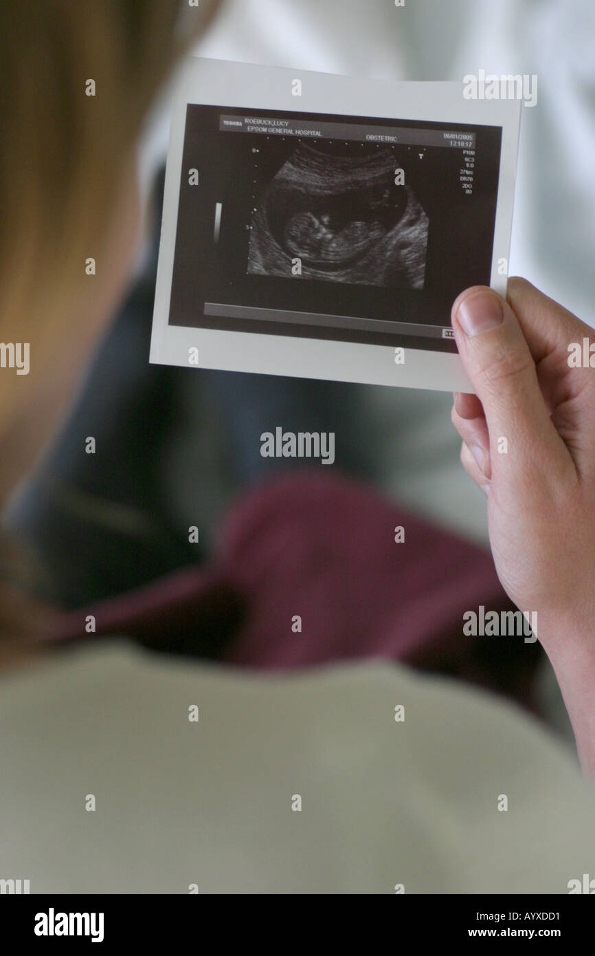 pregnant woman examining scan image Stock Photo - Alamy