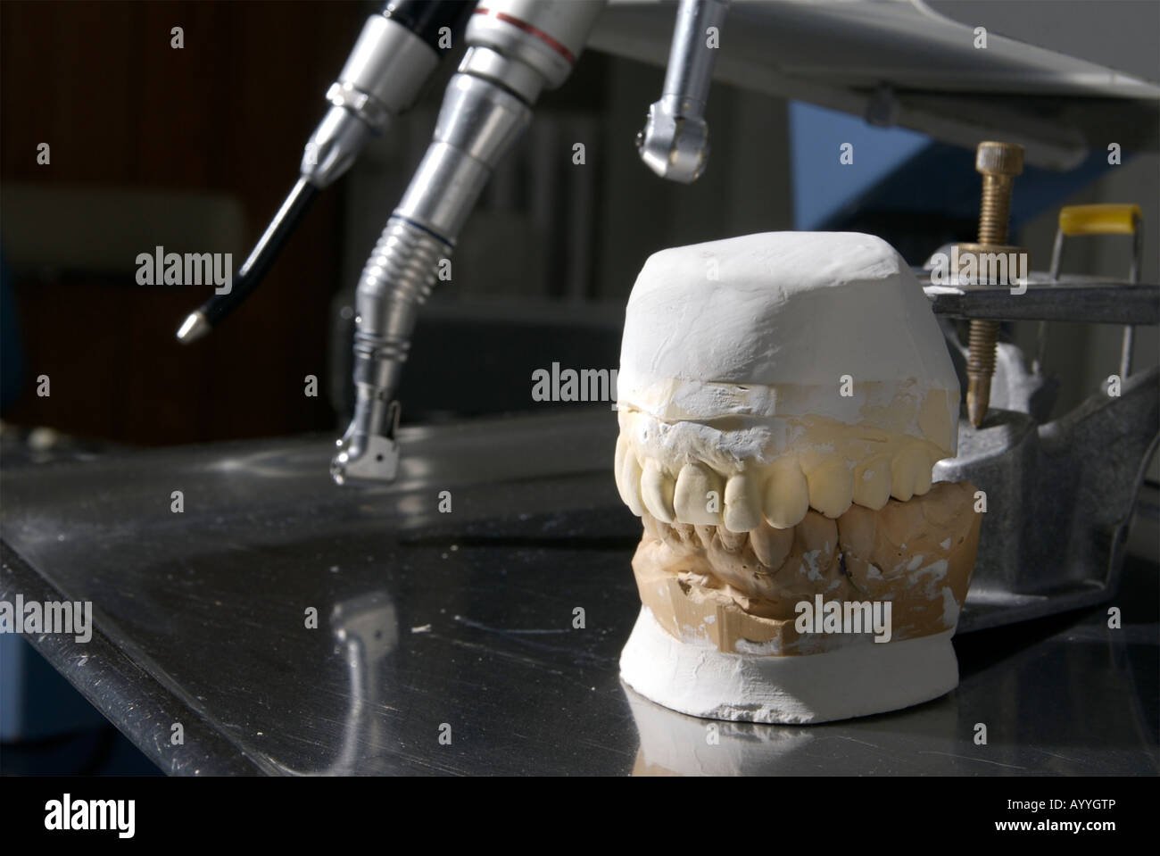 dentist's tools and plaster cast Stock Photo - Alamy