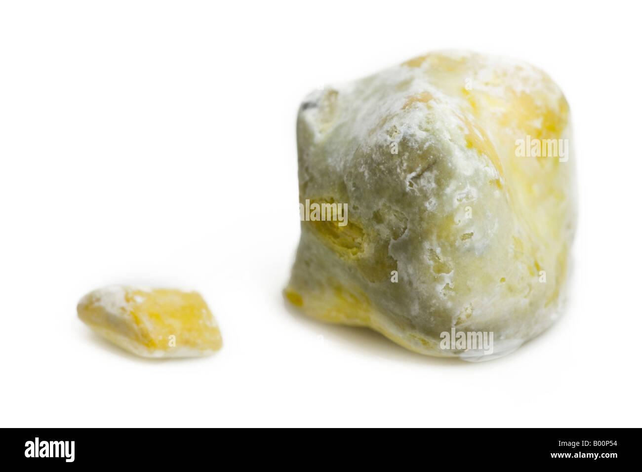 Gall stones hi-res stock photography and images - Alamy